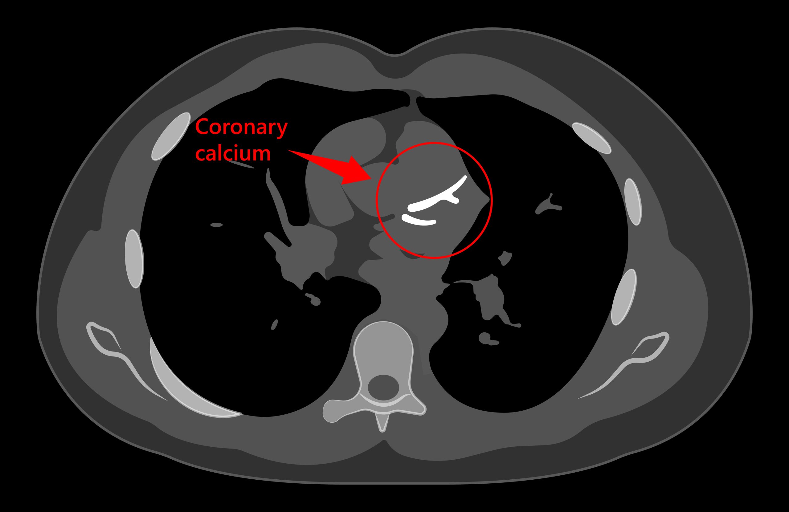 Taking the rough with the smooth when approaching coronary ...